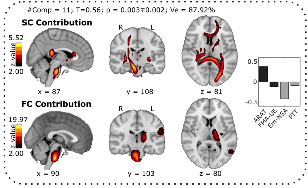 Multimodal and multidomain lesion network mapping enhances prediction of sensorimotor behavior ...